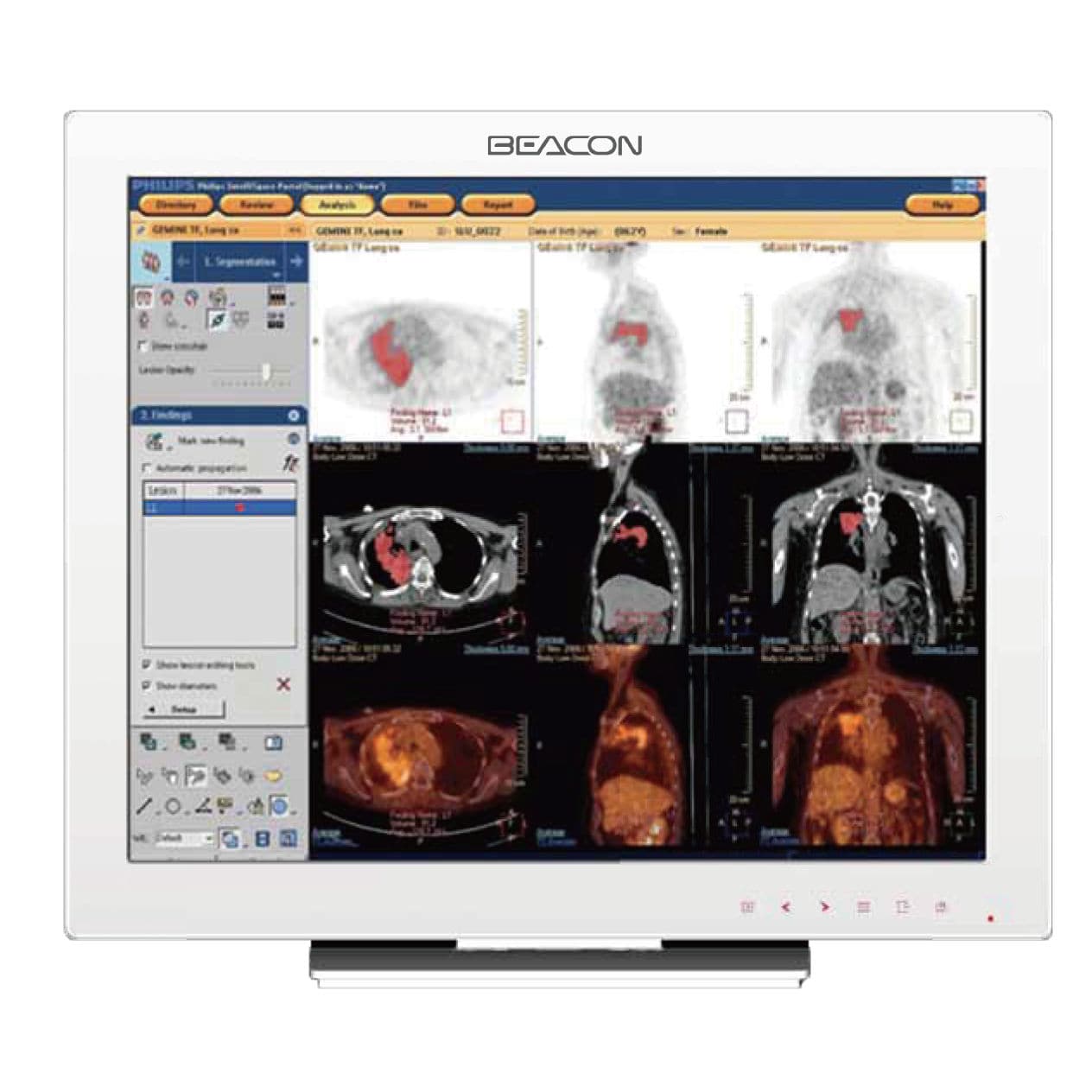 High-definition display - C14ST - Shenzhen Beacon Display Technology ...