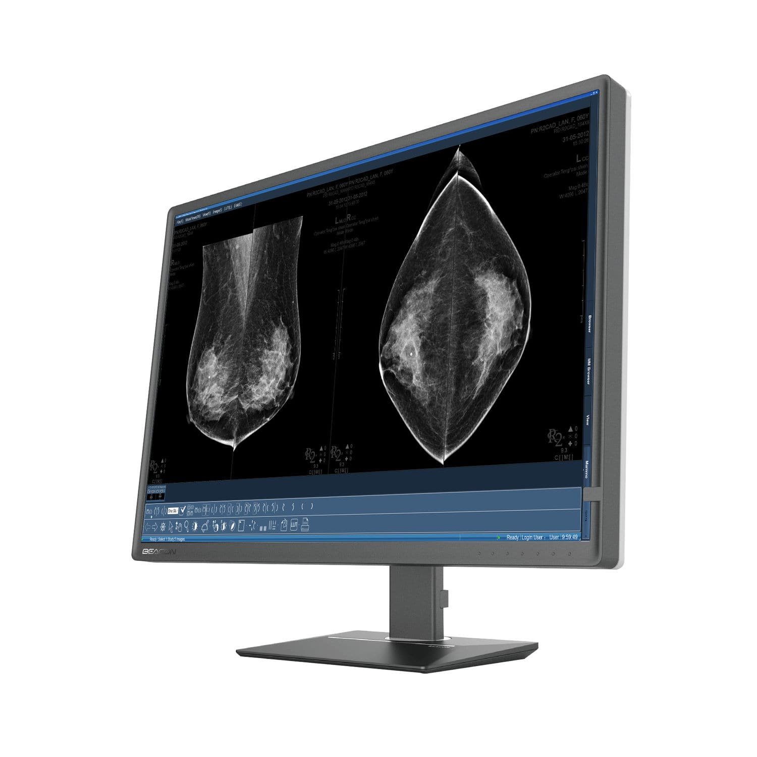Mammography display - C1216W - Shenzhen Beacon Display Technology ...