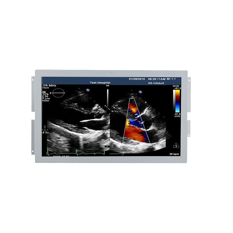 Ultrasound imaging display - U238W - Shenzhen Beacon Display Technology ...