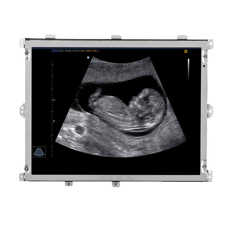 Ultrasound imaging display - U185W - Shenzhen Beacon Display Technology ...