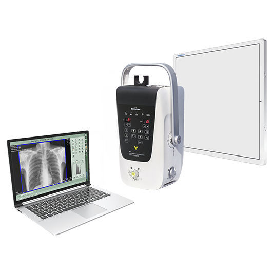 Portable radiography system - Beatle-02P - Browiner - digital / for ...