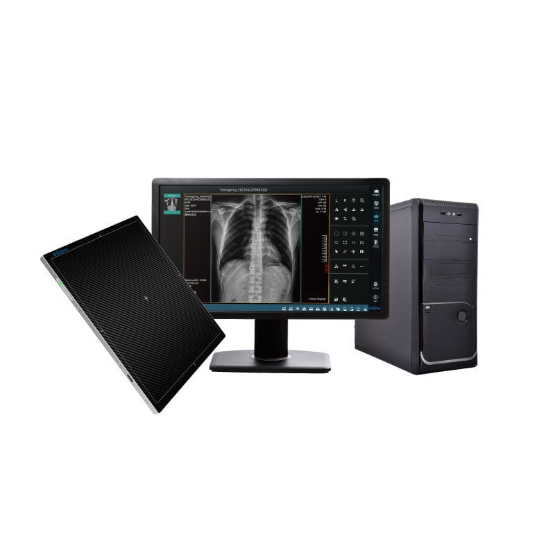 Radiography acquisition system - BRD - Browiner