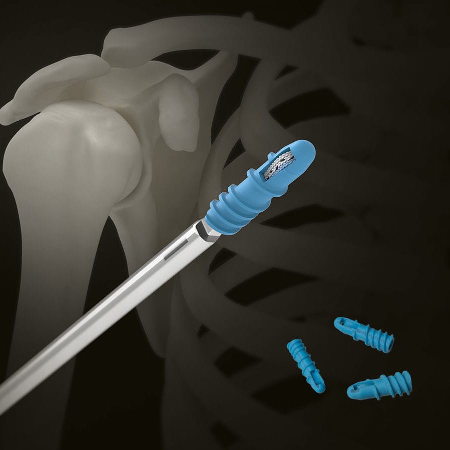 Rotator cuff suture anchor - FixOn™ - Inion - absorbable