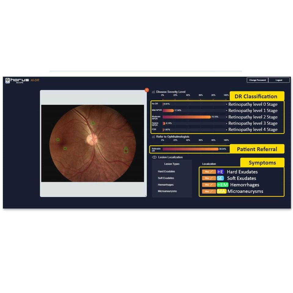 Image analysis software - Medimaging Integrated Solution - diabetic ...