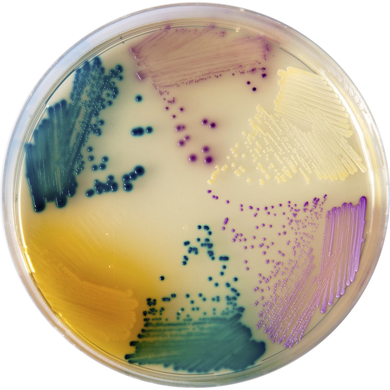 Medium reagent - RT41 series - CHROMagar - for microbiology ...