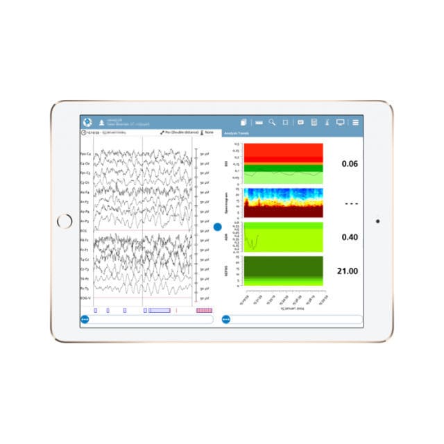 Visualization software - NeuroCenter® - Clinical Science Systems ...