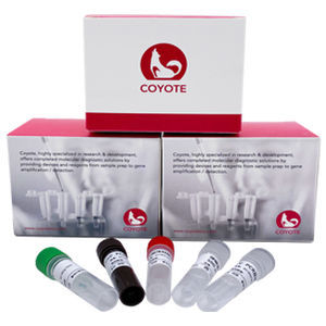 COVID-19 test kit - DirectDetect™ - Coyote Bioscience Company - SARS ...