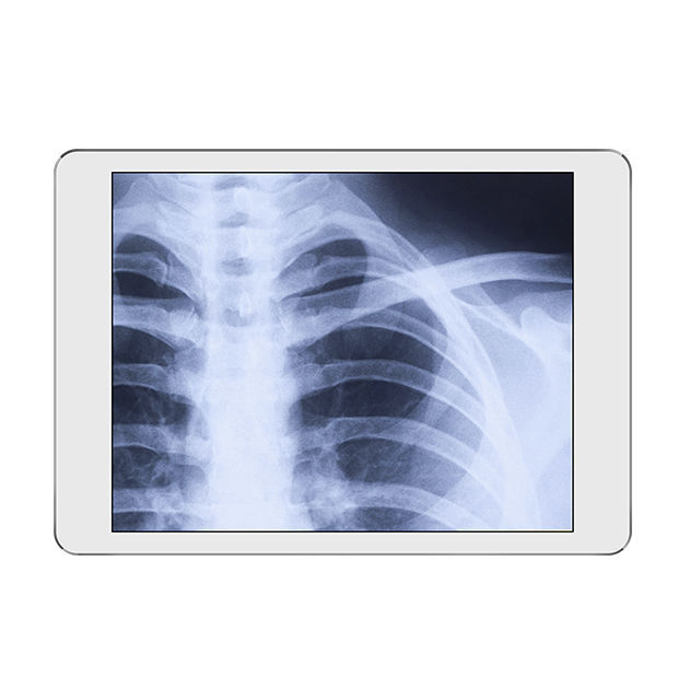 Radiography acquisition system - iRay DR - iRay Technology - portable