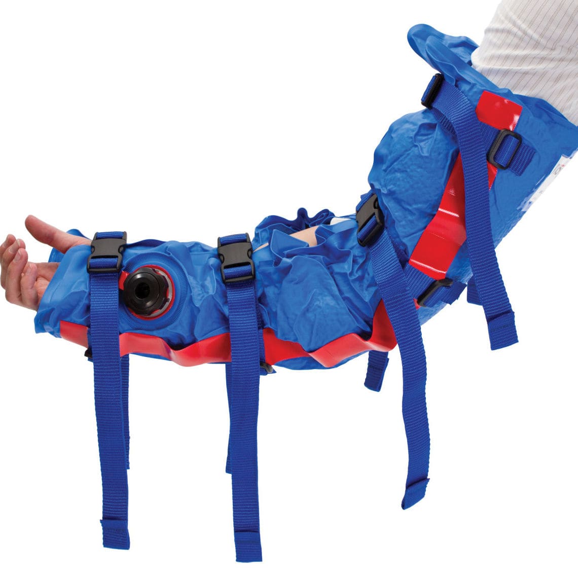 What Is A Vacuum Splint at Carlos Huguley blog