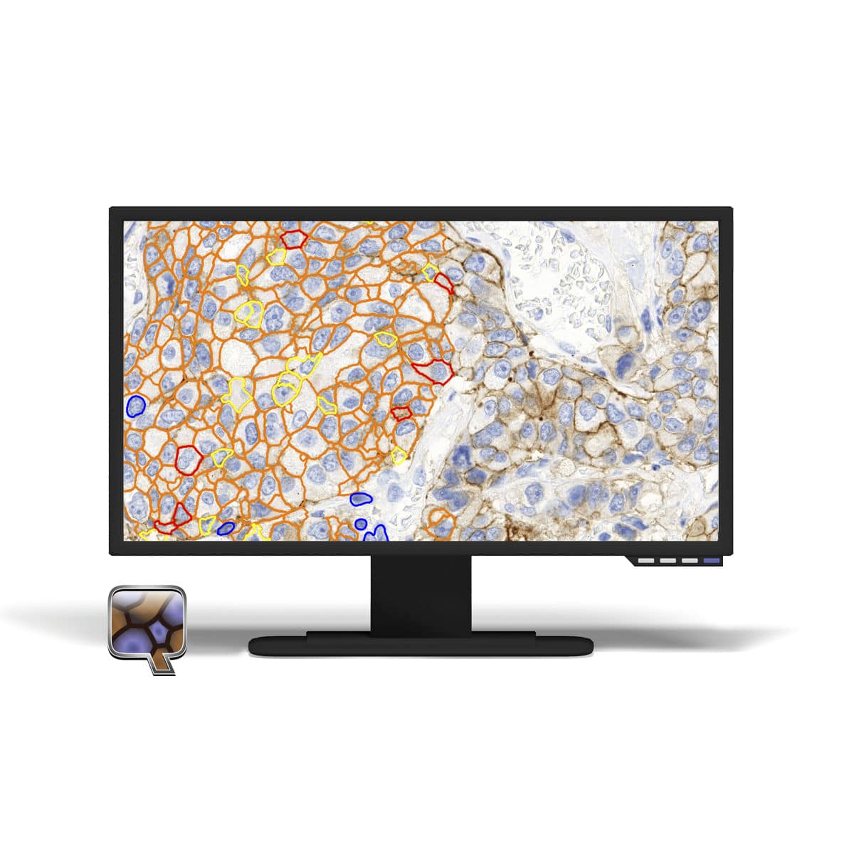 Image analysis software module - MembraneQuant - 3DHISTECH Ltd ...