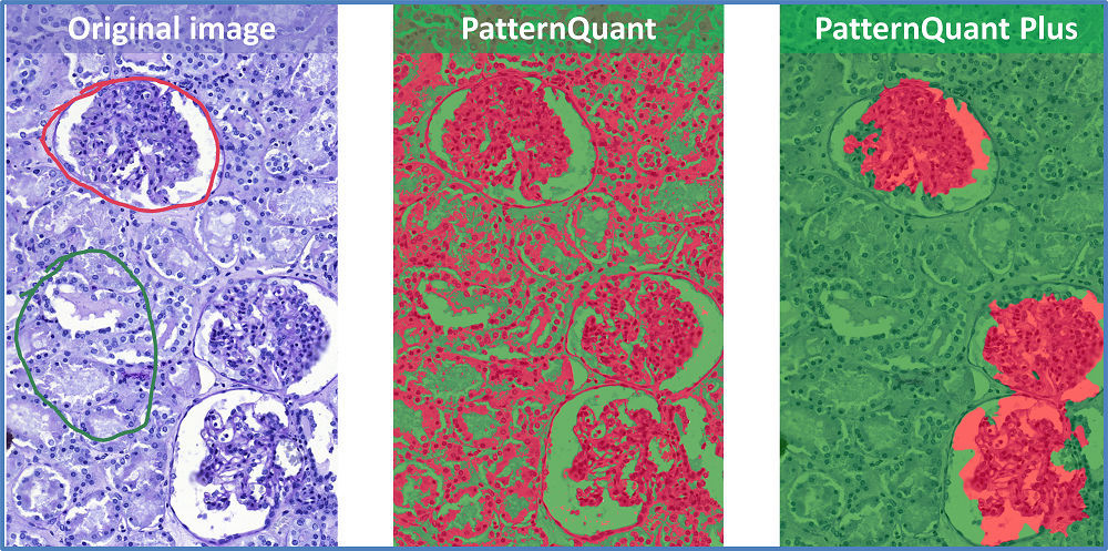 Image analysis software module - PatternQuant Plus - 3DHISTECH Ltd ...