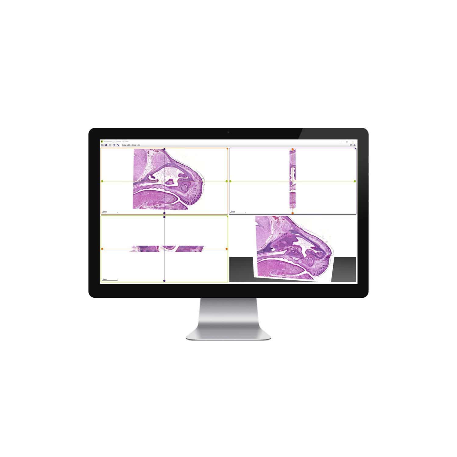 3D viewing software - 3DView - 3DHISTECH Ltd. - measurement / medical / for histology laboratories