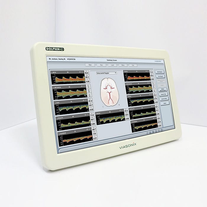 Transcranial doppler - DOLPHIN/4D - Viasonix - table / with touchscreen ...