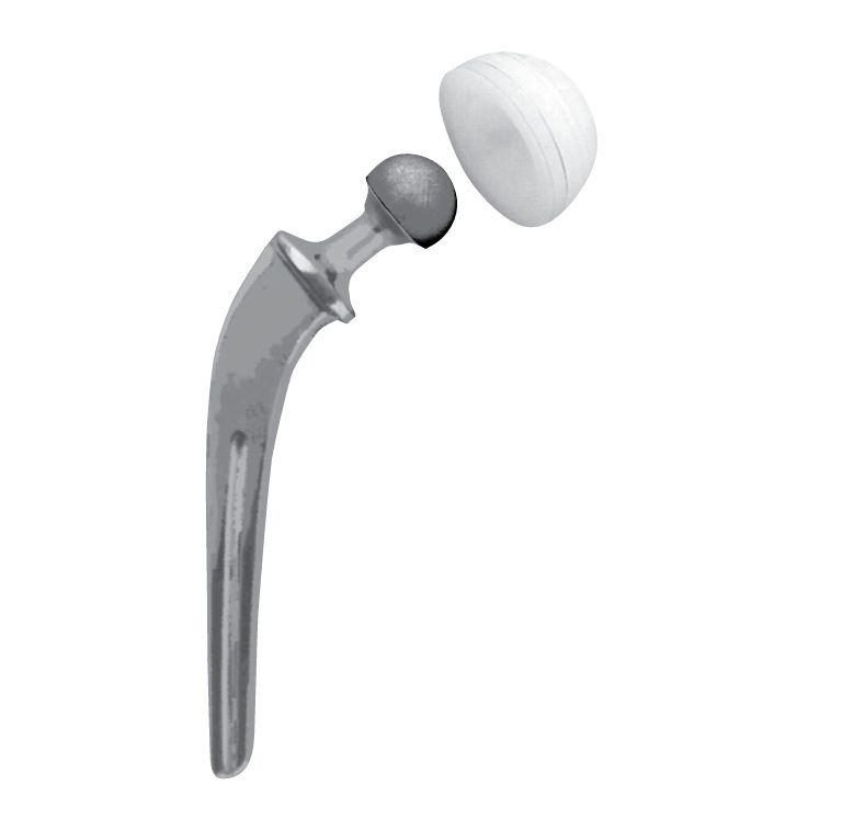 Primary hip prosthesis - 51.450 series - Medicalex - cemented