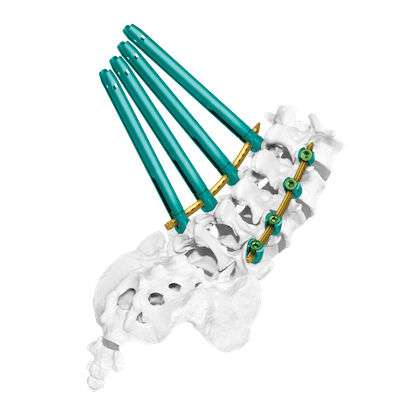 Minimally invasive pedicle screw positioning system - CREO MIS ...