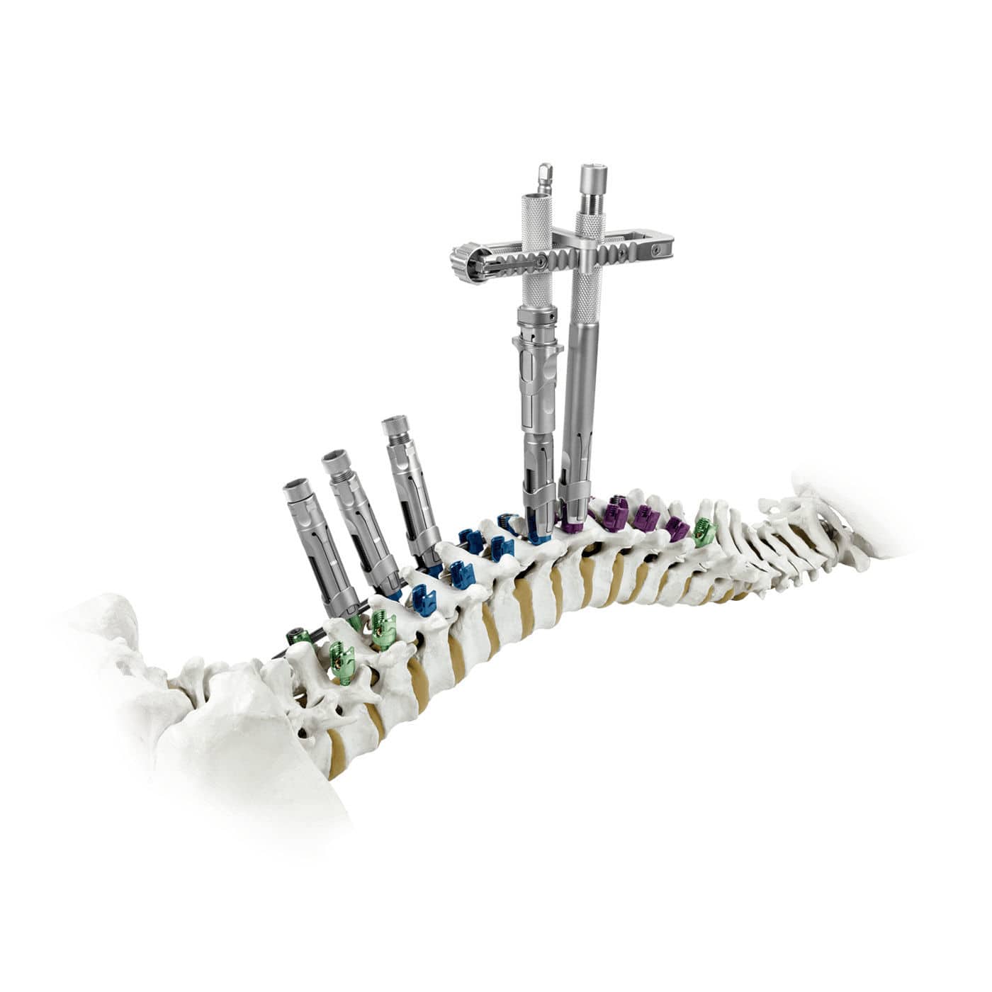 Pedicle screw positioning system - CREO® Derotation - Globus Medical