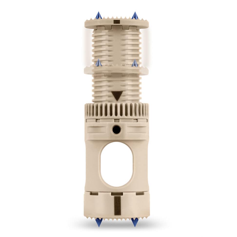 Thoraco-lumbar vertebral corpectomy prosthesis - FORTIFY® - Globus ...