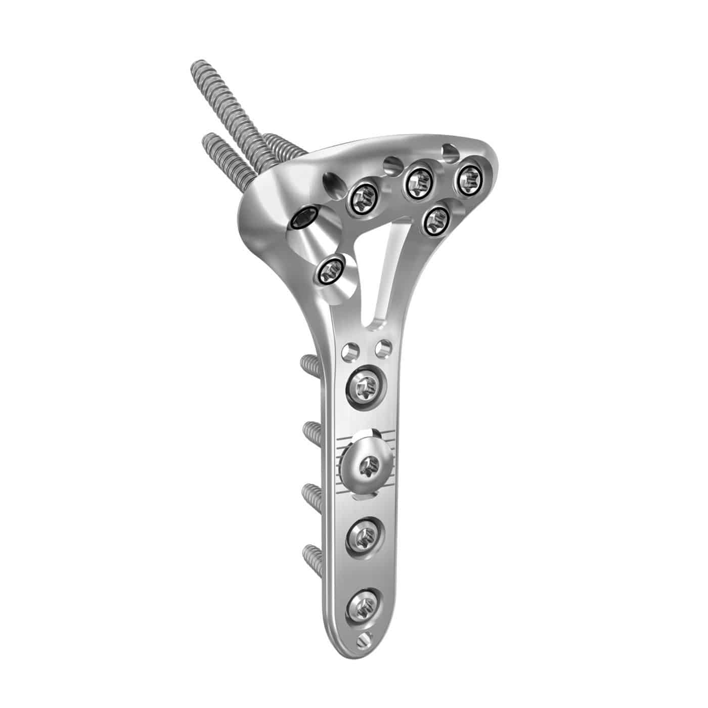 Radius compression plate - ANTHEM® - Globus Medical - wrist / distal ...