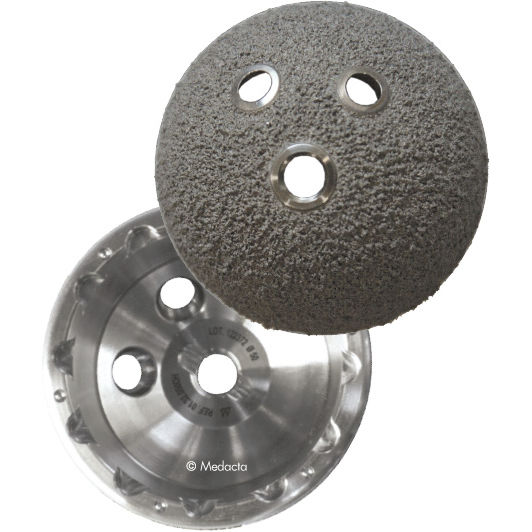 Revision acetabular prosthesis - MPACT® - Medacta - cementless