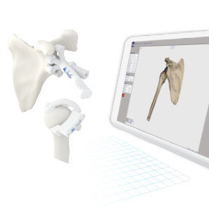 Shoulder prosthesis resection guide - MyShoulder® - Medacta