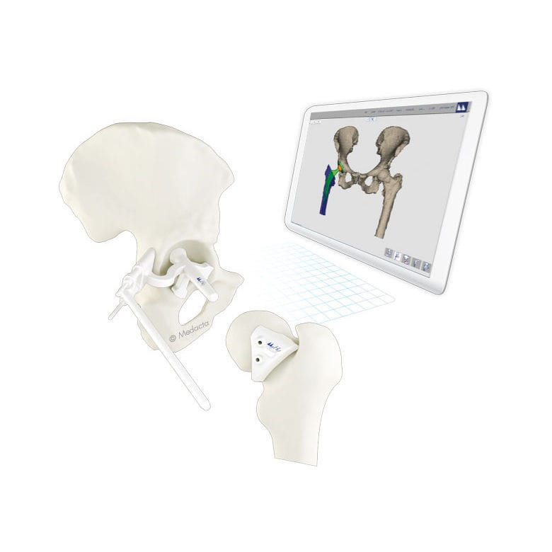 Preoperative planning software - MyHip® - Medacta - orthopedic surgery ...