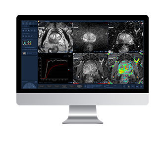 MRI software module - Myrian® XP-Prostate - Intrasense - for ultrasound ...