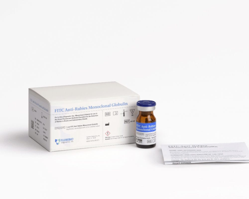 Antibody - FITC - Fujirebio - diagnostic / globulin