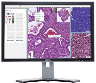 Histopathology laboratory software - Aperio eSlide Manager - Leica ...