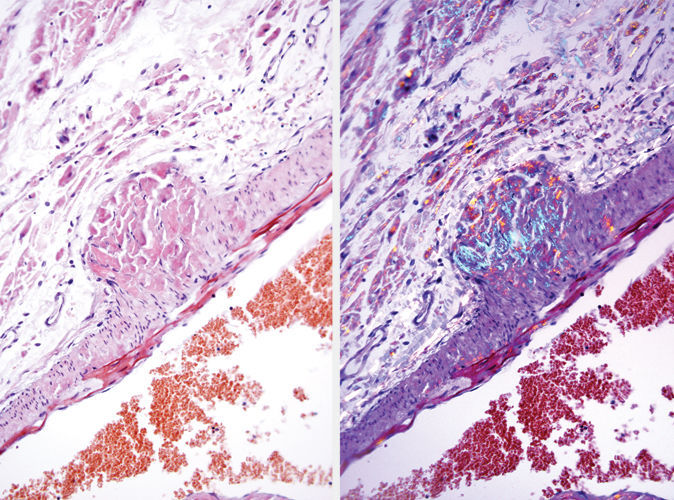 Stain reagent kit - 38016SS9 - Leica Biosystems - for histology