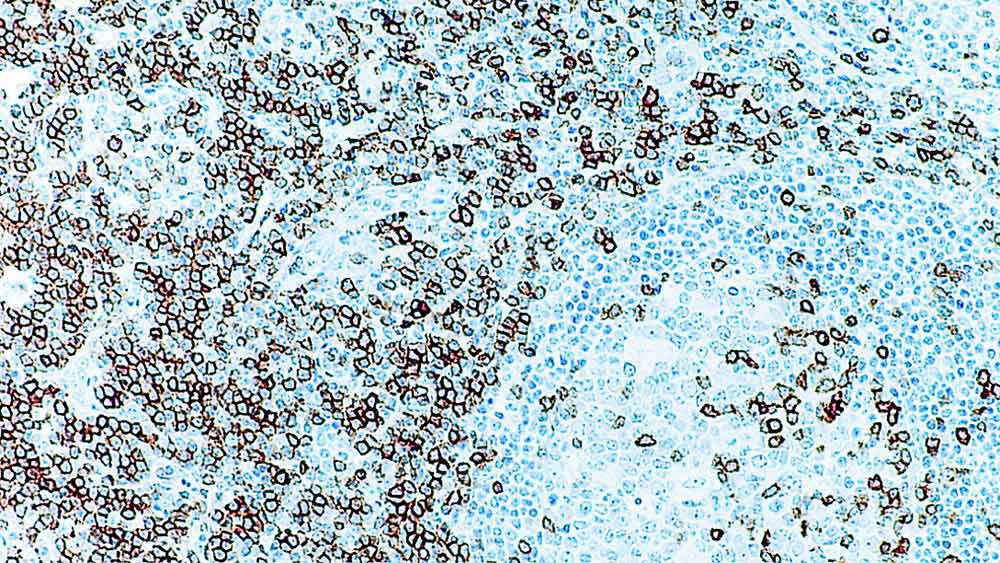 Antigen - CD5 - Leica Biosystems - pathology / for hematology / liquid