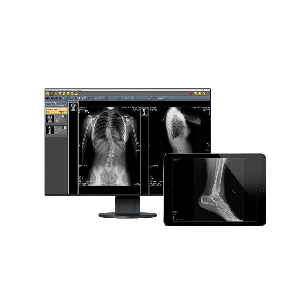 Medical imaging PACS - EvoView - DEL Medical - medical