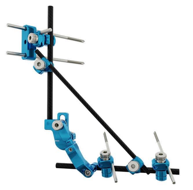 Elbow external fixation system - CLICKIT ER - MIKAI - humerus / tubular ...