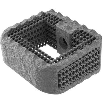 Cervical interbody fusion cage - NEXXT MATRIXX® - Nexxt Spine ...