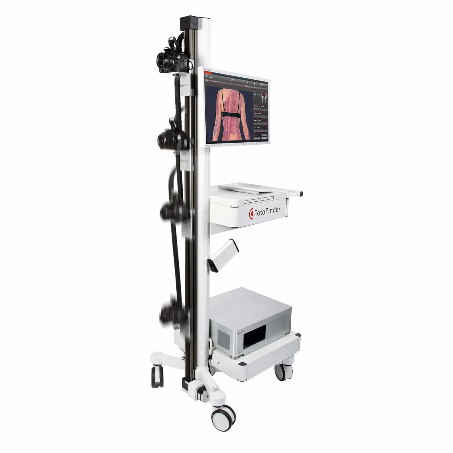 Skin psoriasis severity analysis system - PASIvision - FotoFinder Systems