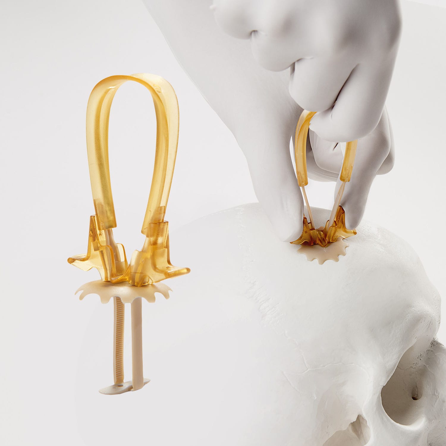 Non-absorbable cranial fixation system - COVER™ - NEOS Surgery