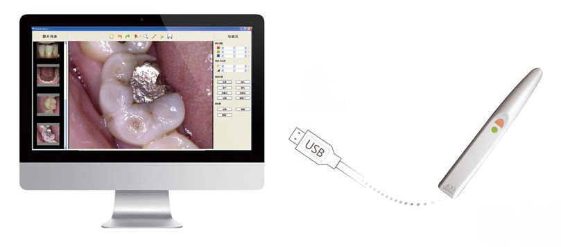 Intraoral camera - EzCam - Handy Technologies - digital / CMOS