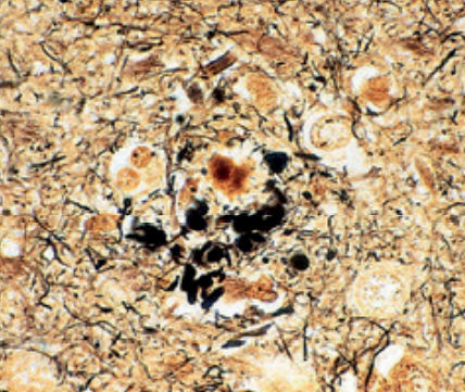 Staining solution reagent - Bielschowsky - BIO-OPTICA Milano - for ...