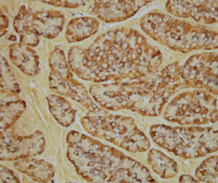 Staining solution reagent - Grimelius - BIO-OPTICA Milano - for ...