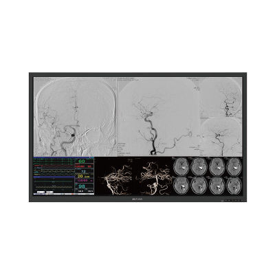 Surgical display - S5810 - Nanjing Jusha Display Technology - 3840 × ...