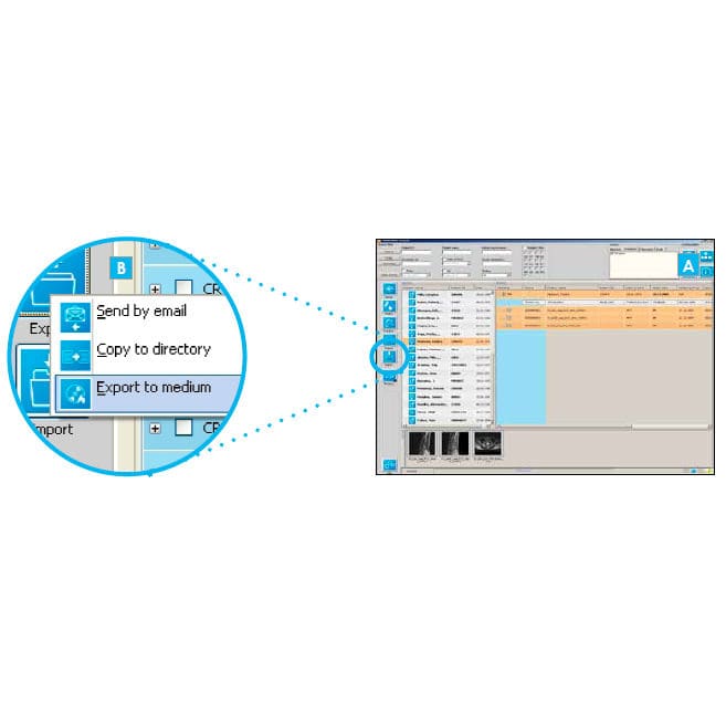 Medical imaging software - iQ-ROBOT series - IMAGE Information Systems ...