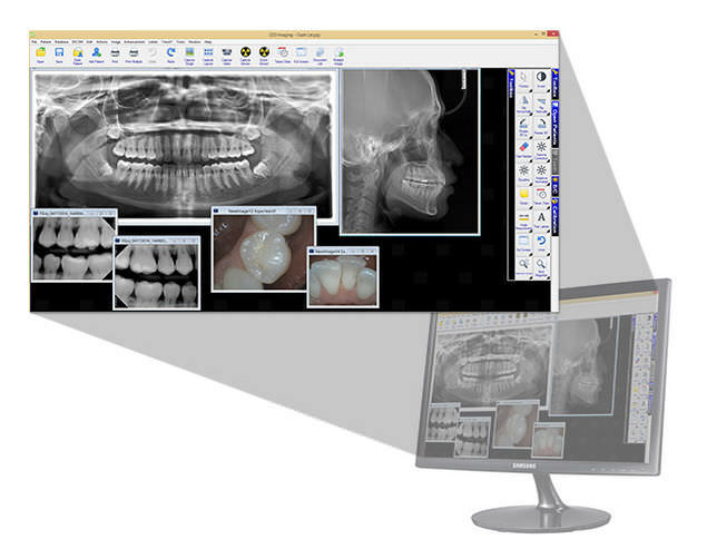 Visualization software - LED Dental - analysis / for dental imaging ...