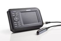 Hand-held ultrasound system - All medical device manufacturers