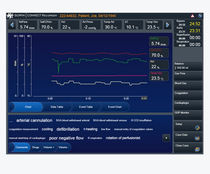 LivaNova: Secondary care - MedicalExpo