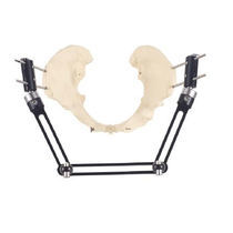 External fixation system - All medical device manufacturers