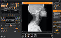 Radiography software, X-ray imaging software - All medical device ...