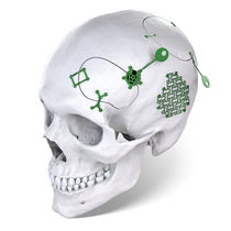 Cranial fixation system - All medical device manufacturers