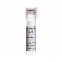 Immunohistochemistry reagent, Immunohistochemistry reagent kit - All ...