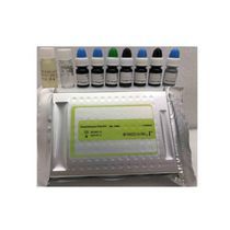 Biochemistry test kit, Biochemical assay kit - All medical device ...