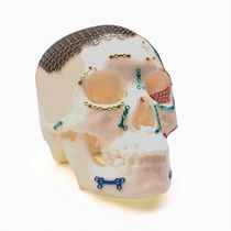 Non-absorbable cranial fixation system - All medical device manufacturers