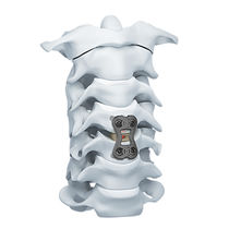 Mediox: Secondary care - MedicalExpo